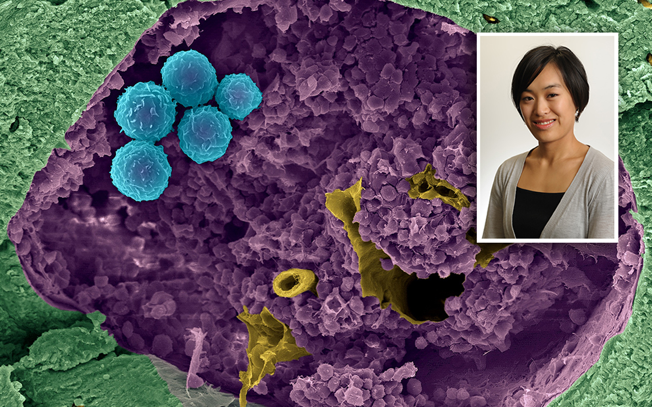 MJA Podcasts 2018 Episode 32: Child stem cell donors, with Dr Shih-Ning ...