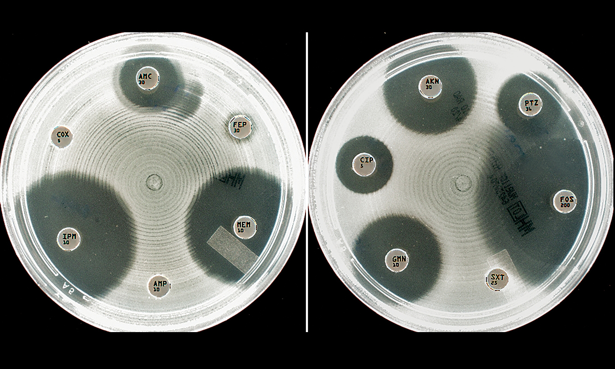 First reported case of extensively drug‐resistant typhoid in Australia ...