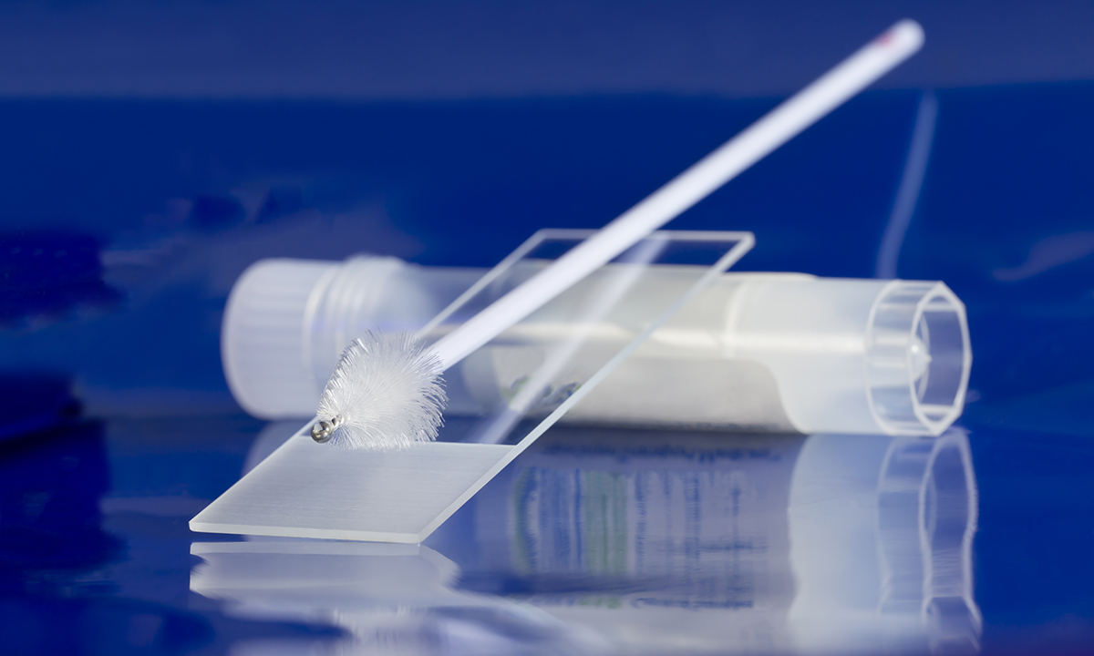 Self‐collection for HPV screening: a game changer in the elimination of ...