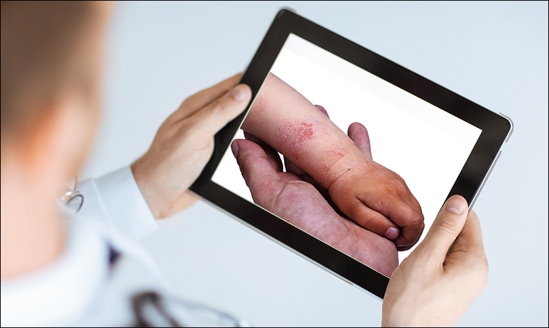 Teledermatologists’ management of emergency skin conditions | The ...