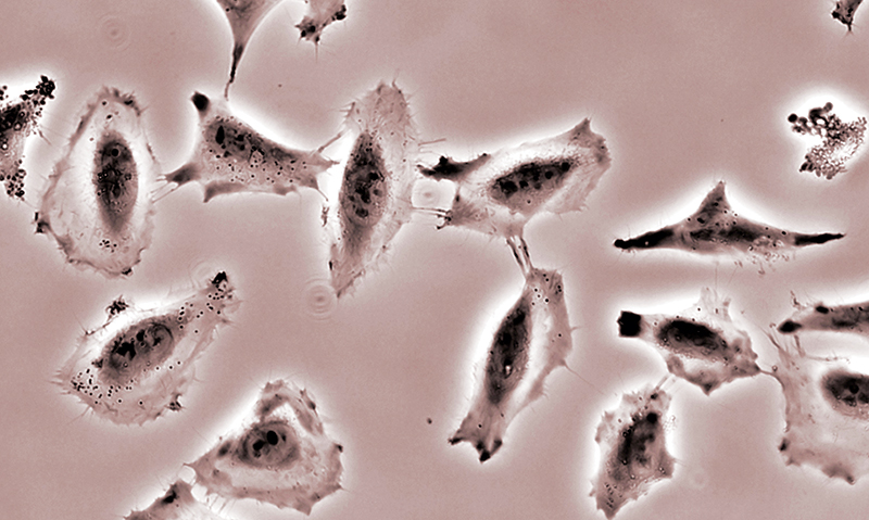 Self-sampling HPV testing versus mainstream cervical screening and HPV ...