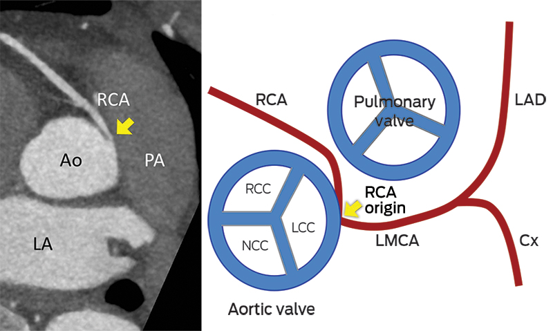 The clinical utility of new cardiac imaging modalities in Australasian ...
