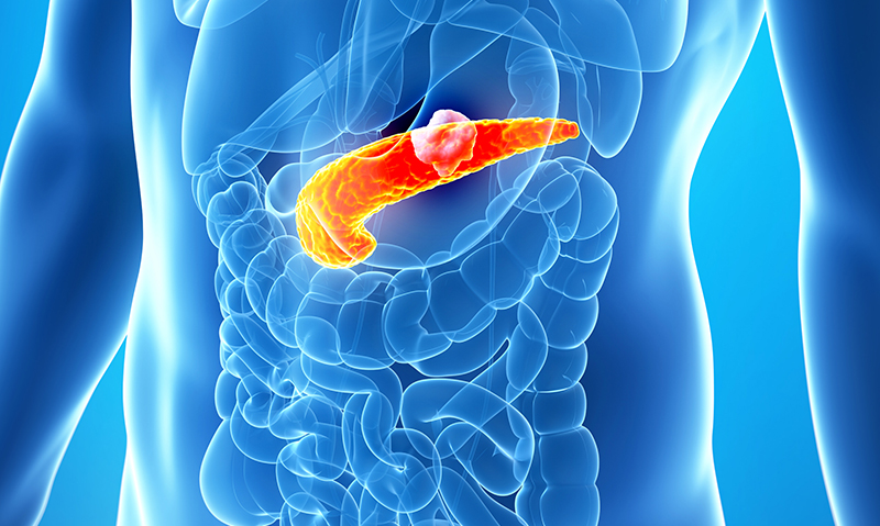 Centralising care for patients with pancreatic cancer: a hybrid model ...