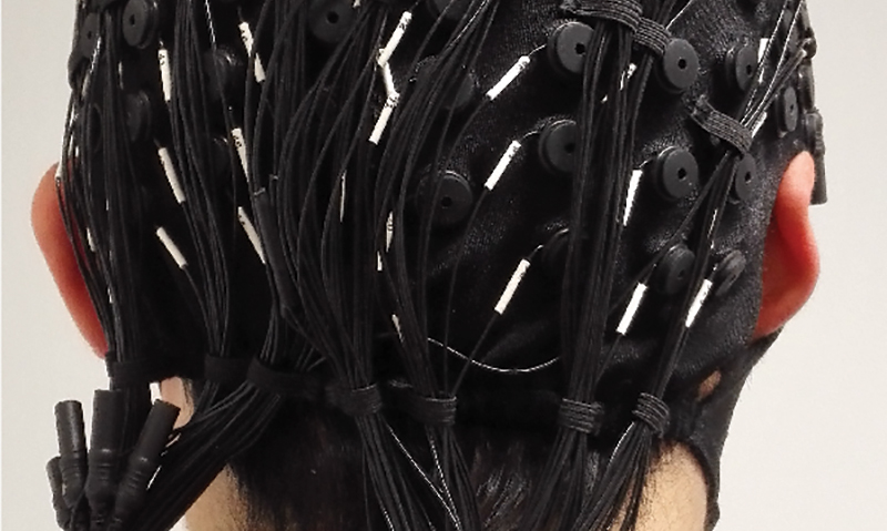 Neurobionics and the brain–computer interface: current applications and ...