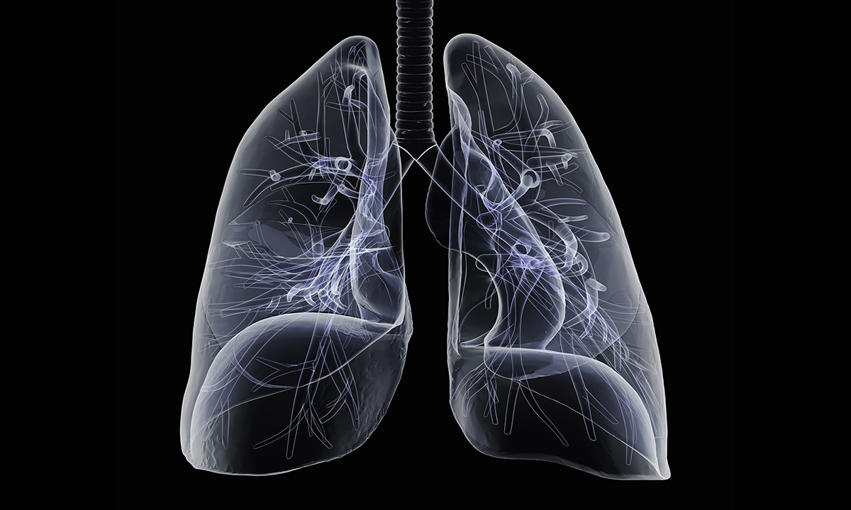 COPD-X Australian and New Zealand guidelines for the diagnosis and ...