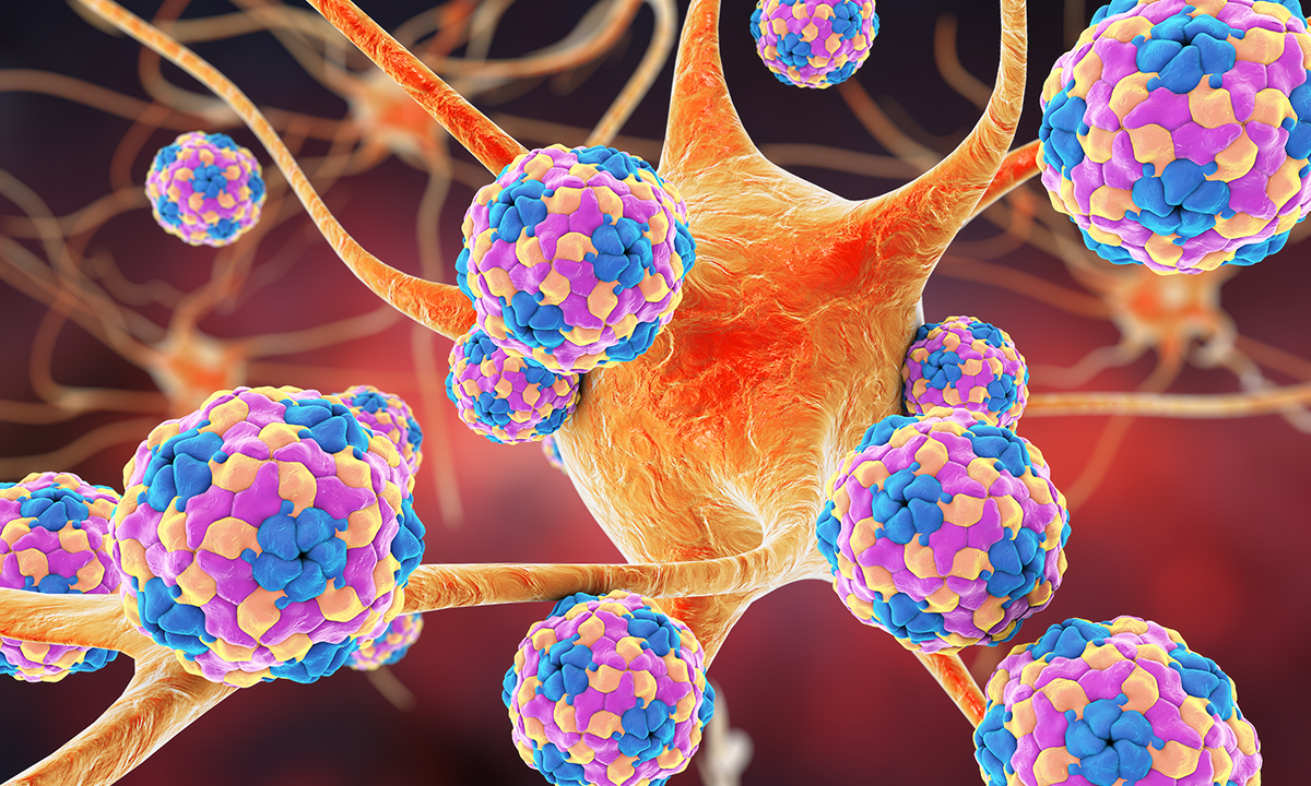 Parechovirus: an important emerging infection in young infants | The ...