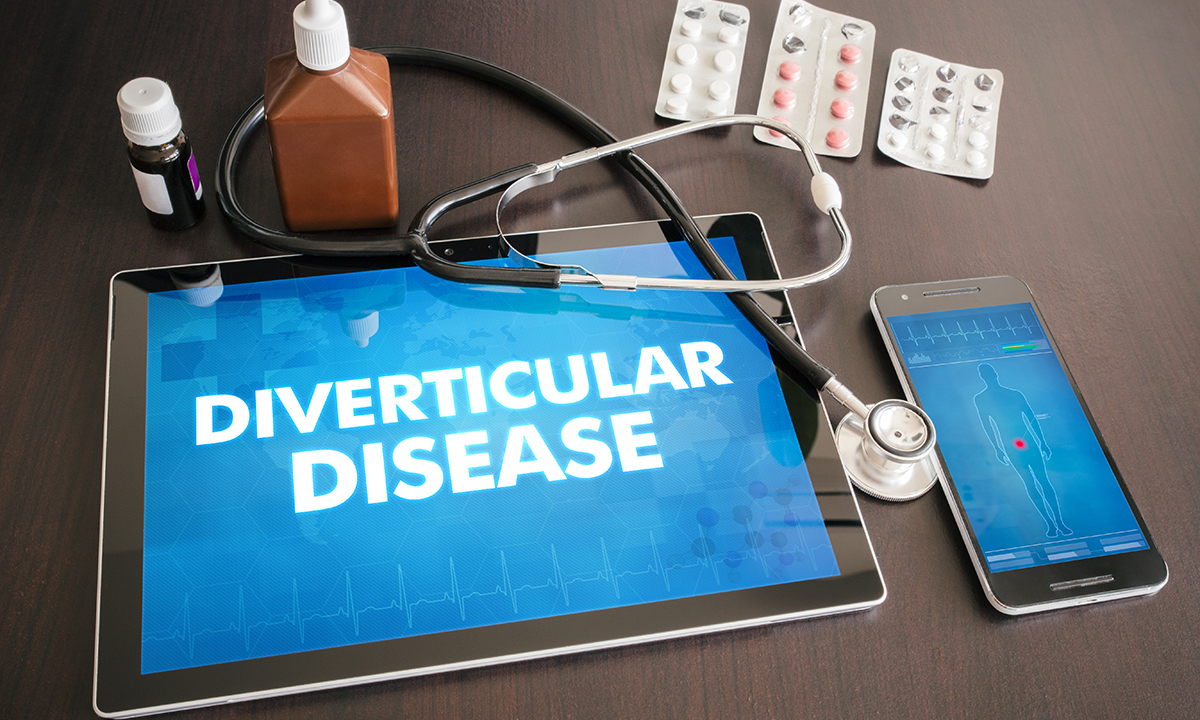 The management of diverticulitis: a review of the guidelines | The ...
