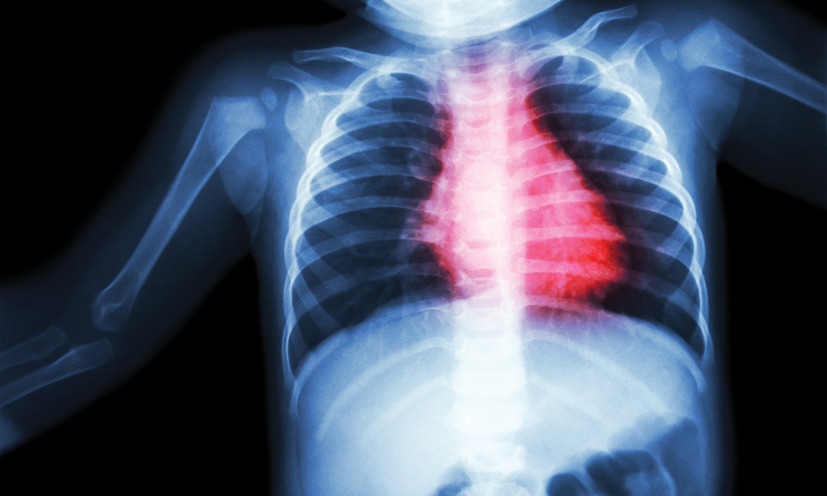 Community leadership and empowerment are essential for eliminating ...