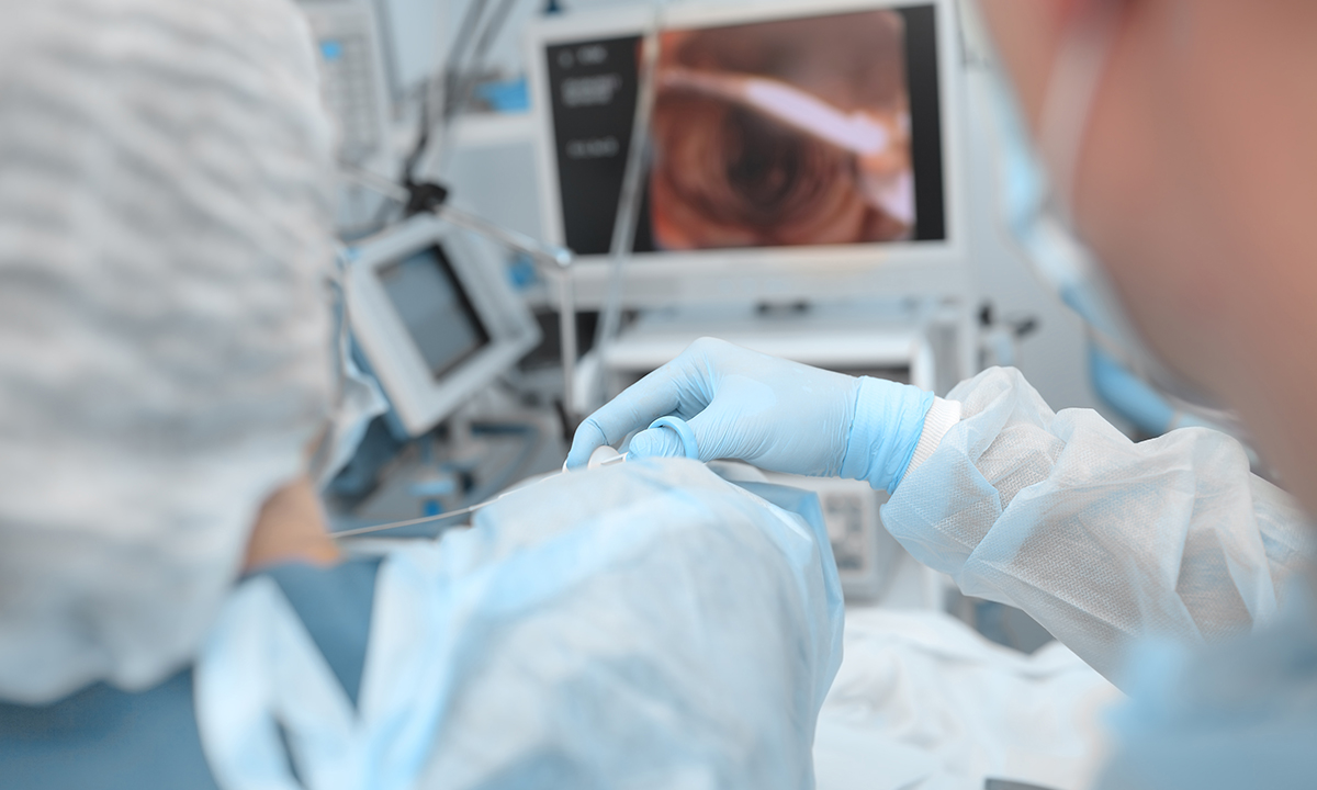 Interventional bronchoscopy for chronic obstructive pulmonary disease ...