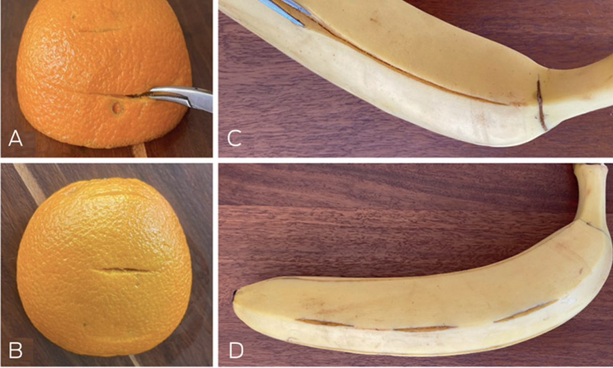 “A banana a day keeps wound failure away”: comparing the utility of ...