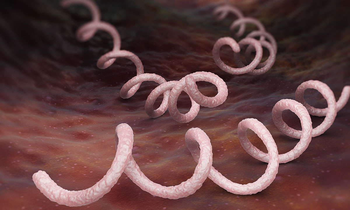 Congenital syphilis on the rise: the importance of testing and ...